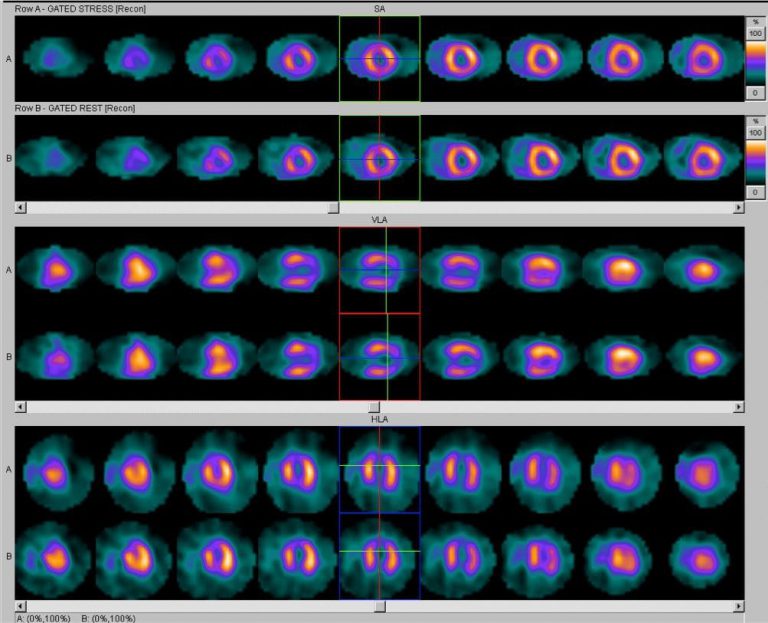 Case Study 3 | Mobile PET Scan | Cardiac Imaging. Inc.