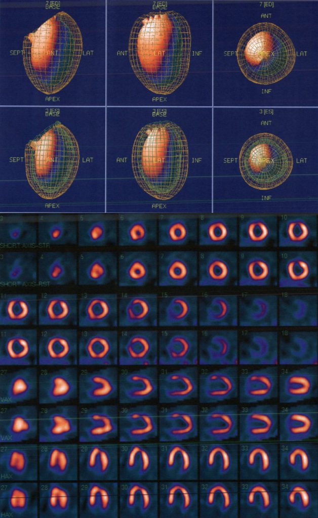 Case Study 4 | Mobile PET Scan | Cardiac Imaging, Inc.